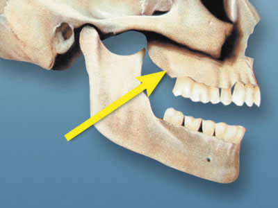 Maxillary Tuberosity 14 Dento Osseous Structures Blood Vessels And
